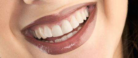 Dents - Quelle est la structure et la fonction de la gencive ? - Fiches ...