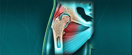 Hanche - Quelles sont les fonctions de la hanche ? - Fiches santé et ...