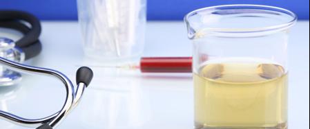 Hématurie (Sang dans les urines) - Quelles causes ? - Fiches santé et ...