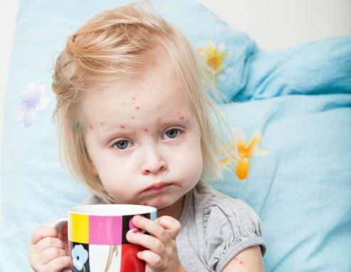 Rubéole - Quels symptômes ? - Fiches santé et conseils médicaux