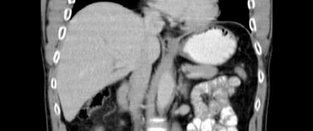 Scanner thoracique - Quelles indications ? - Fiches santé et conseils ...