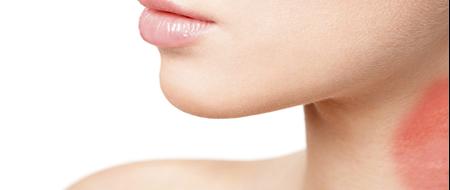 Rougeur - Qu’est-ce que c’est ? - Fiches santé et conseils médicaux