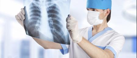 Pneumologie - Qu’est-ce que c’est ? - Fiches santé et conseils médicaux