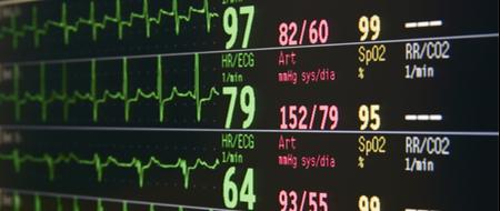 Réanimation médicale - Qu’est-ce que c’est ? - Fiches santé et conseils ...