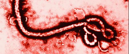 Filarioses - Qu'est ce que c'est ? - Fiches santé et conseils médicaux