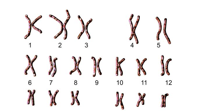 Caryotype - Qu’est-ce que c’est ? - Fiches santé et conseils médicaux