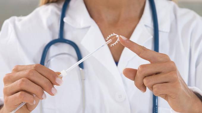 Stérilet - Qu'est-ce que c'est? - Fiches santé et conseils médicaux