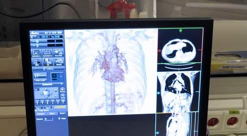 Le scanner cardiaque permet de voir les coronaires