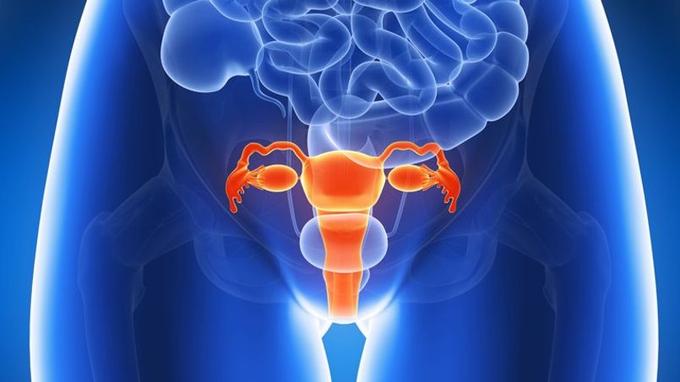 Le cancer de l'utérus ne doit pas être négligé