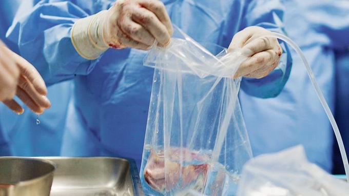 Greffe d'organe: vers la fin de l'incompatibilité