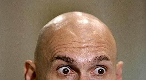 Pourquoi les hommes deviennent chauves