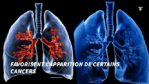 C'est quoi une particule fine