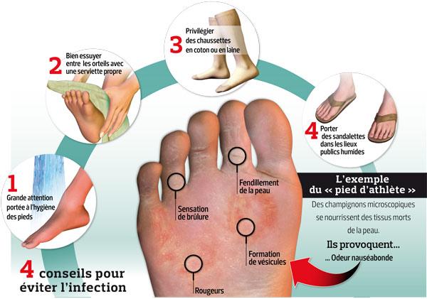 Les mycoses cutanées ont encore la peau dure