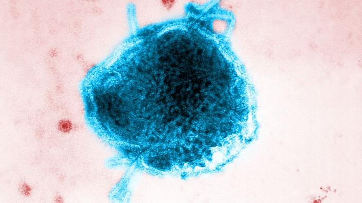 Le virus de la rougeole testé contre un cancer incurable