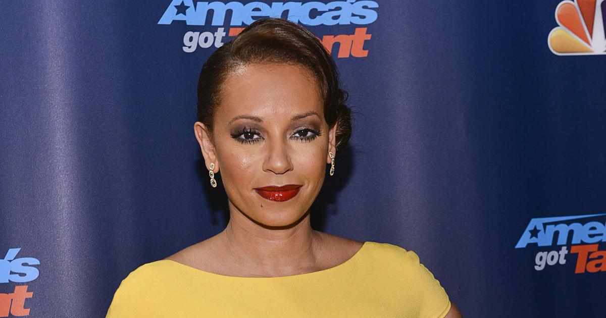 Mel B, à moitié aveugle