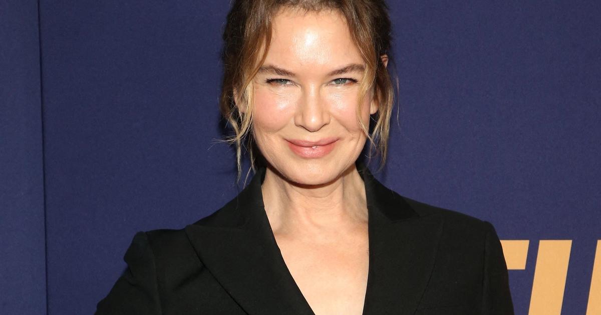PHOTOS - Renée Zellweger : découvrez son évolution physique