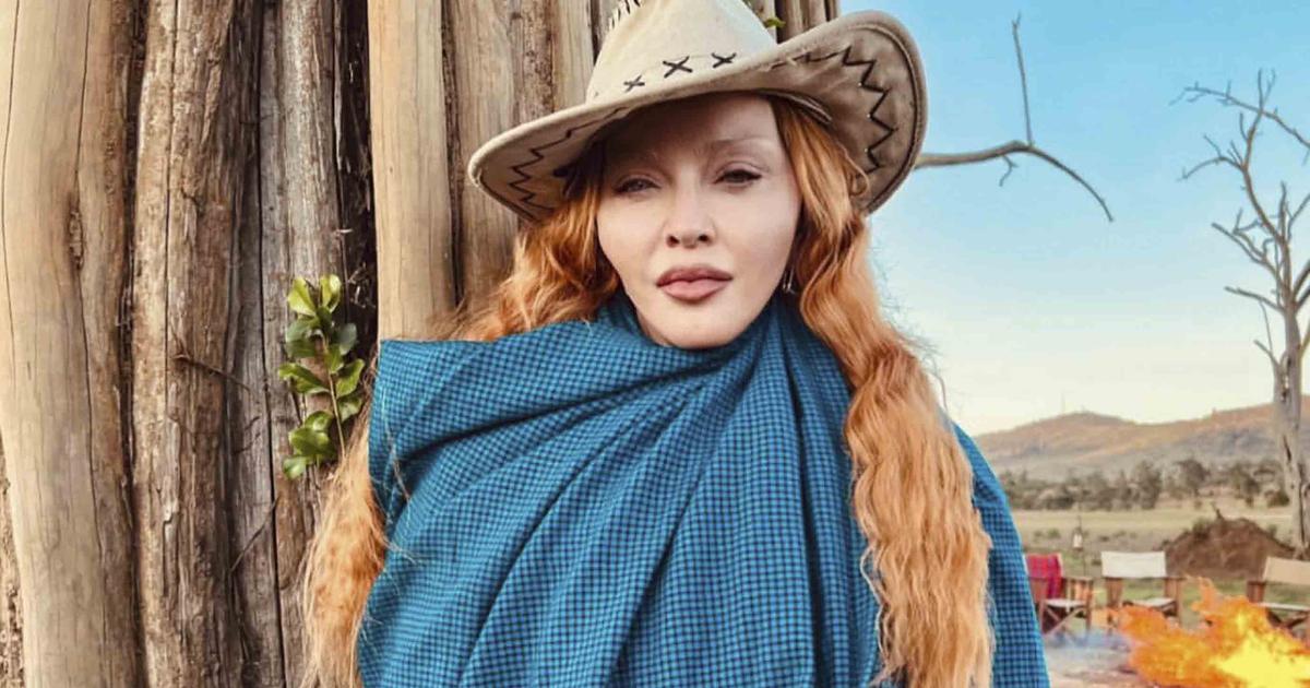 PHOTO - Madonna transformée par la chirurgie, elle s’amuse ...