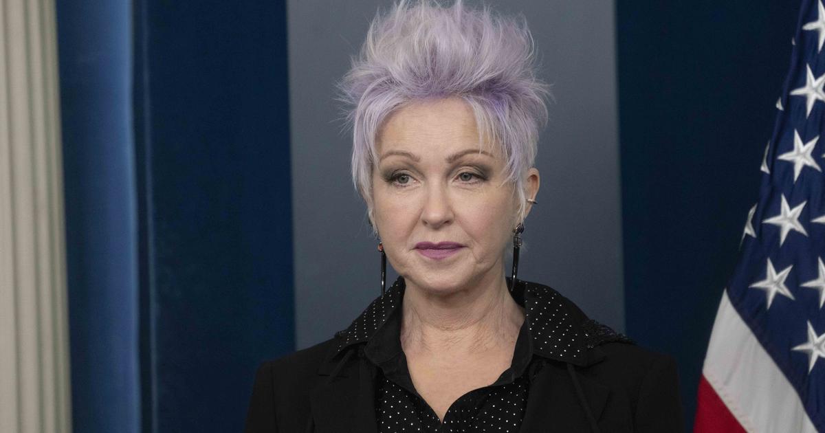Cyndi Lauper a 70 ans : cette maladie dont souffre la chanteuse