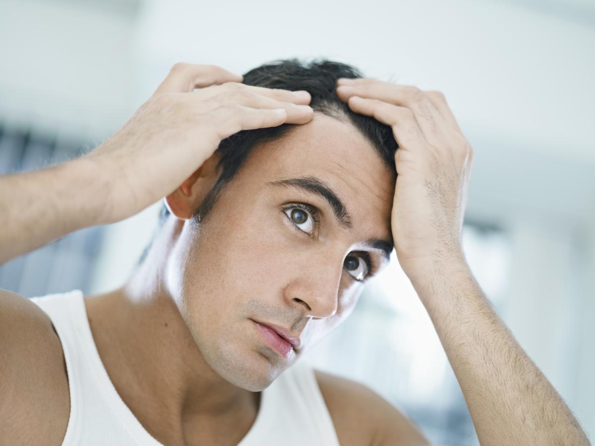 Perte de cheveux hommes : comment la limiter ? - Madame Figaro