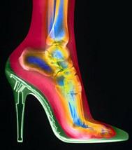 Motion 81 contre les talons hauts