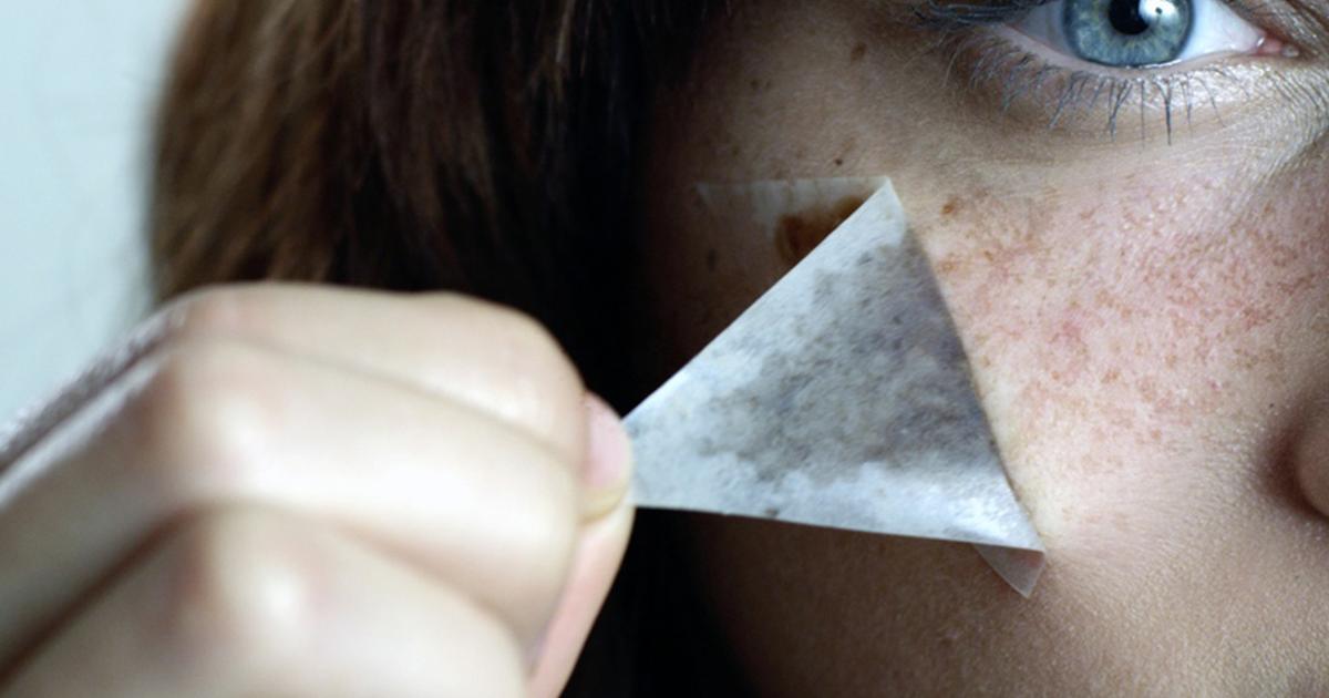 "Freck Yourself" : le kit pour des taches de rousseur plus vraies que ...